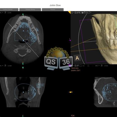 Cs 3d Imaging V3 10 Full Qs36 Shop