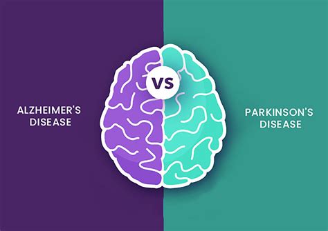 The Differences Between Alzheimers And Parkinsons Disease
