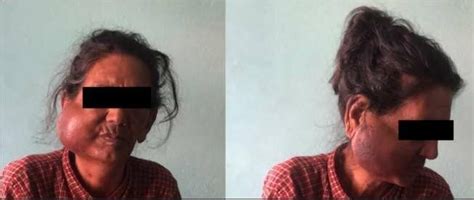 Patient Presentation Demonstrating Facial Mass Download Scientific