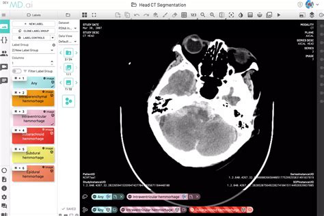 model performance md ai documentation