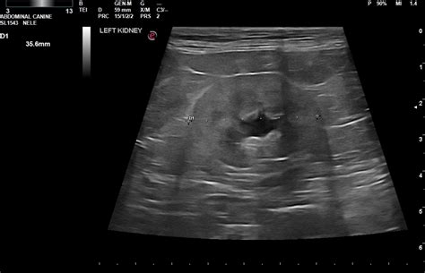 Small Intestinal Obstruction With Annular Mass In A 14 Year Old Mn Dsh