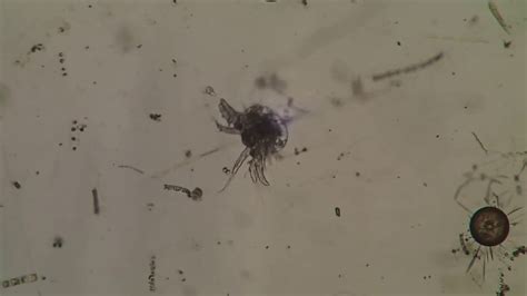フジツボ類のノープリウス幼生Nauplius larva YouTube