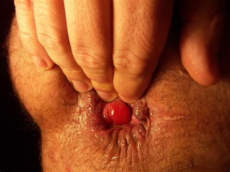 I Love Xtreme Fisting Set