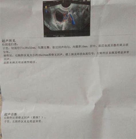 有經驗的寶媽們進來幫我看看吧！ 每日頭條