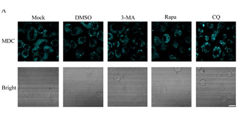 Rapamycin Sirolimus Mtor Inhibitor Medchemexpress