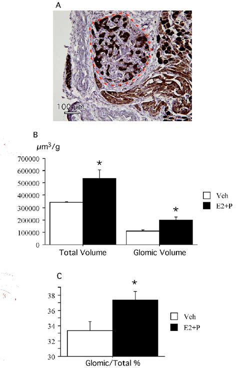 Influence Of Chronic Postnatal Exposure To Estradiol And Progesterone