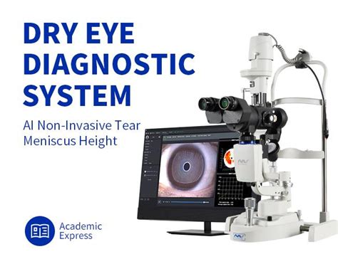 İ tek medikal on linkedin tear meniscus height detection based on deep