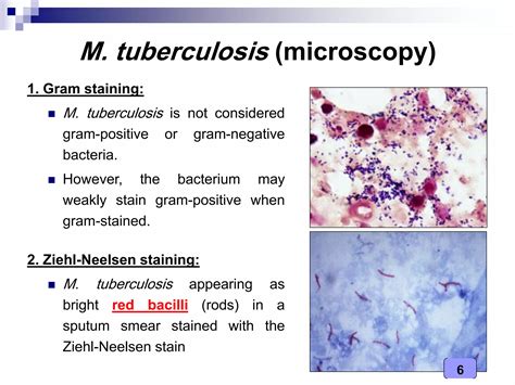 Medical Microbiology Laboratory Mycobacterium Spp Pdf
