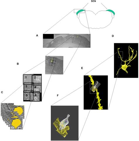 Steps Involved In The Imaging Segmentation And Reconstruction Of Download Scientific Diagram