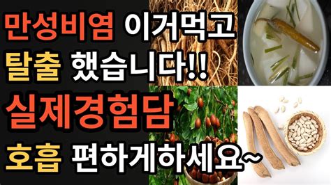 만성비염 이거먹고 탈출 했습니다 실제경험담 ㅣ 호흡 편하게 하세요~ Youtube
