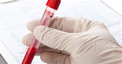 Santé Un test sanguin prometteur pour détecter le cancer de façon précoce