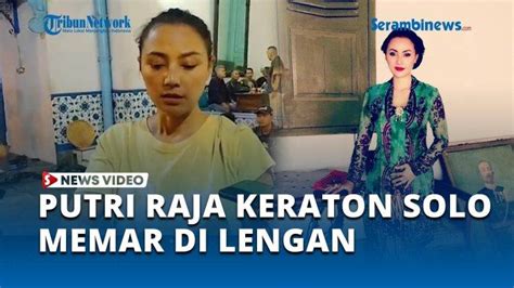 Video Devi Lelyana Dewi Putri Raja Keraton Solo Alami Memar Di Tangan
