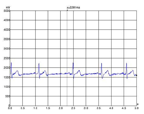 Electrocardiogram Ecg Circuit Diagram For Oscilloscopes