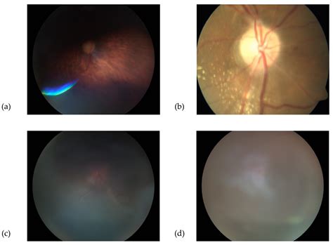 A Deep Learning System For Automated Quality Evaluation Of Optic Disc