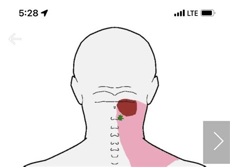 뒷목 뒤통수 저부분이 뭔가 느낌이 이상해요 궁금할 땐 아하