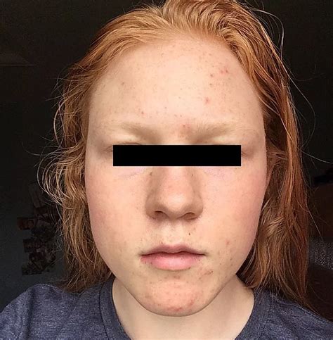 Before And After Derma Drink