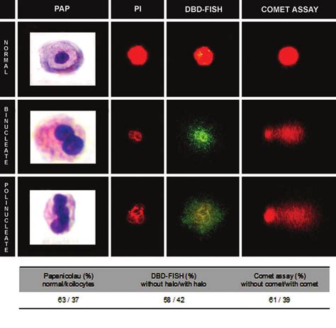 Papa Nicolaou Stained Cervix Epithelial Cells Showing P R O P I D I U Download Scientific