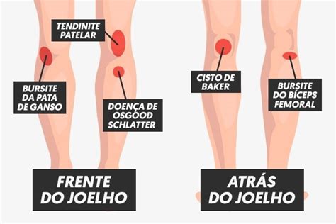 Dor no joelho causas comuns e o que fazer Portal Amazônia On