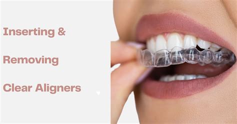 How To Wear And Remove Invisalign Clear Aligners In Turkey Antalya