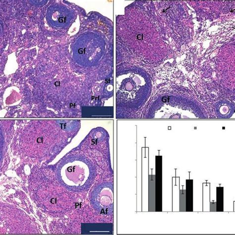 Photomicrographs Of Ovarian Tissue Stained With Hande 160Â And