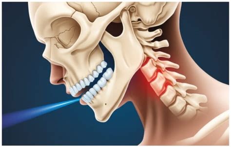Is Your Ear Pain Actually Tmj Unraveling The Tmj Ear Infection