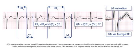 Using 12 Lead Ecg To Detect Drug Induced Long Qt Interval The Gold