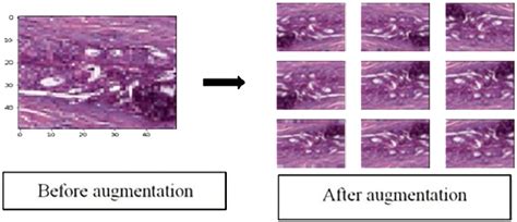 Figure 1 From Integration Of Convolutional Neural Network And Extreme