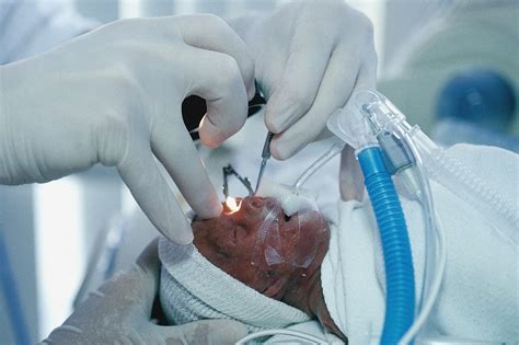 Retinopathy Of Prematurity Incidence Nearly Doubled In Years