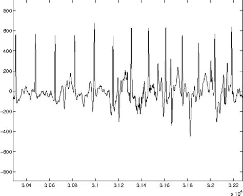 Figure 1 From Robust Detection Of Atrial Fibrillation For A Long Term Telemonitoring System