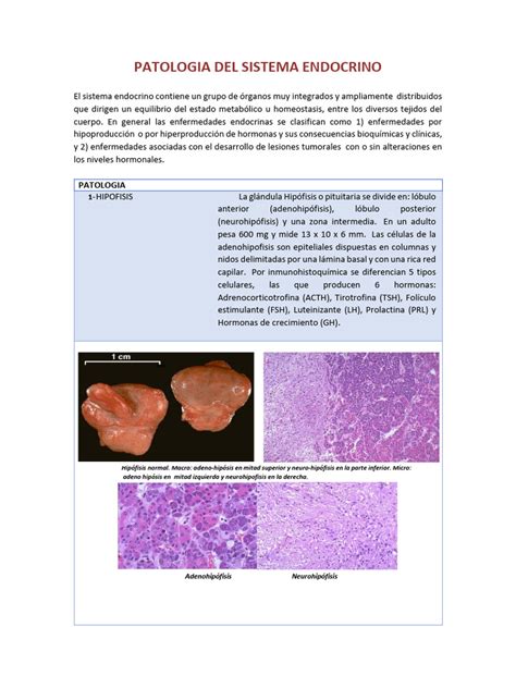 Patologia Del Sistema Endocrino Pdf Glándula Pituitaria