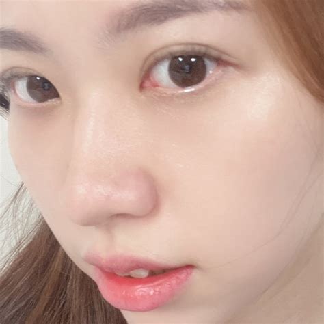 부산서면피부과 요즘 핫한 리쥬란힐러후기 네이버 블로그