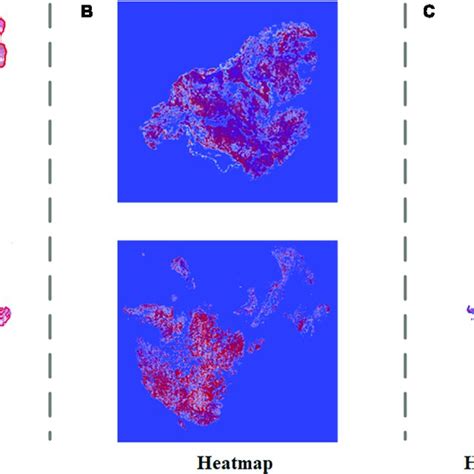 Visualization Heatmap Of Pathological Slides Based On Ssl A The