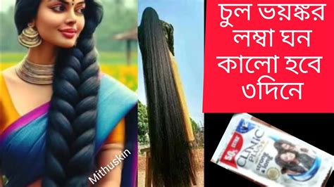 শ্যাম্পুর সাথে মেশান ২ টি উপাদান চুল হবে ১০ গুন লম্বা ঘন সিল্কিও