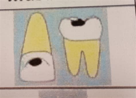 Blacks Classification Surfaces Of Decay Flashcards Quizlet