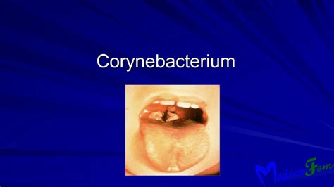 Diphtheria Corynebacterium Diphtheriae And Anthrax Bacillus