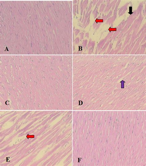 Heart Tissue Sections Of Sham Operated Group Aab Group And Treated