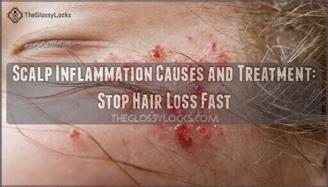 Scalp Inflammation Causes And Treatment Stop Hair Loss Fast