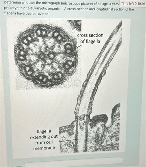 Answered Determine Whether The Micrograph Microscope Picture Of A