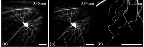 Yfp Labeled Ganglion Cell Imaging Using Fluorescent Slo With Different