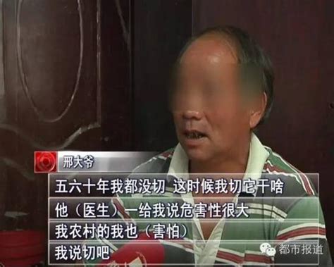 正常包皮真实图片晒晒自己的大基吧 随意云