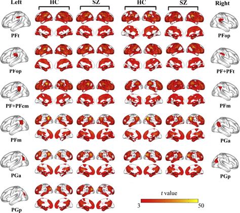 The Rsfc Map Of Each Ipl Subregion Within Each Group Only The Positive
