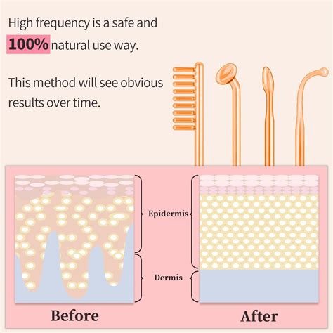 Tumakou Portable High Frequency Facial Machine Skin Wand Device For