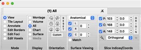 Surface Based Analysis For Neocortex Diedrichsen Lab