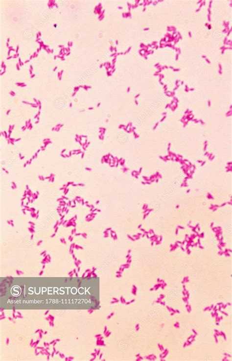 Yersinia Pestis Formerly Pasteurella Pestis The Bubonic Plague