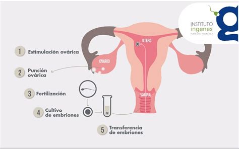 Fecundación in vitro FIV Vida Positiva
