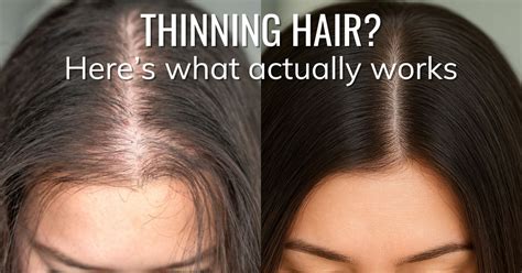 My Hair Is So Thin I Can See My Scalp Steps To Boost Hair Density