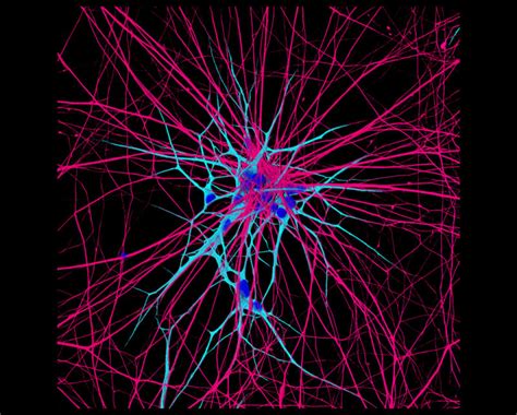 Ipsc Derived Human Neurons Nikon Small World