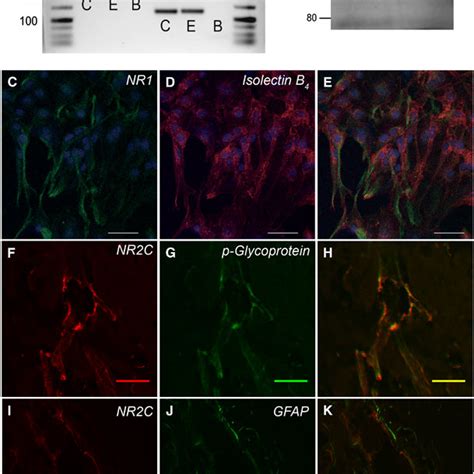 Brain Endothelial Cells Express N Methyl D Aspartate Nmda Receptor