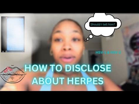 HOW TO TELL SOMEONE YOU HAVE HERPES YouTube