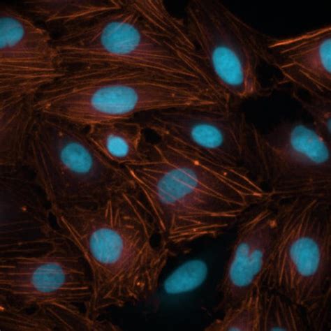 Cellular Imaging Systems High Content Screening Digital Microscopy